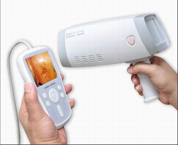Colposcope cervical de la cámara del PDA de Digitaces para que ...